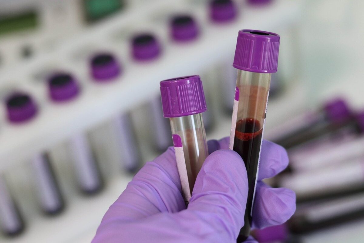 Get Tested! Going Beyond Routine Bloodwork – AXIS Personal Trainers